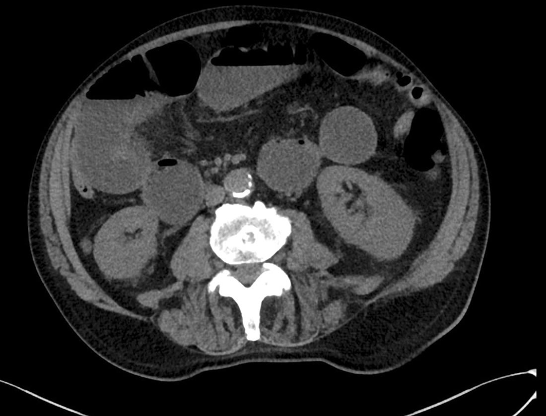 Exercise - Övning i röntgendiagnostik - Uppsala universitet