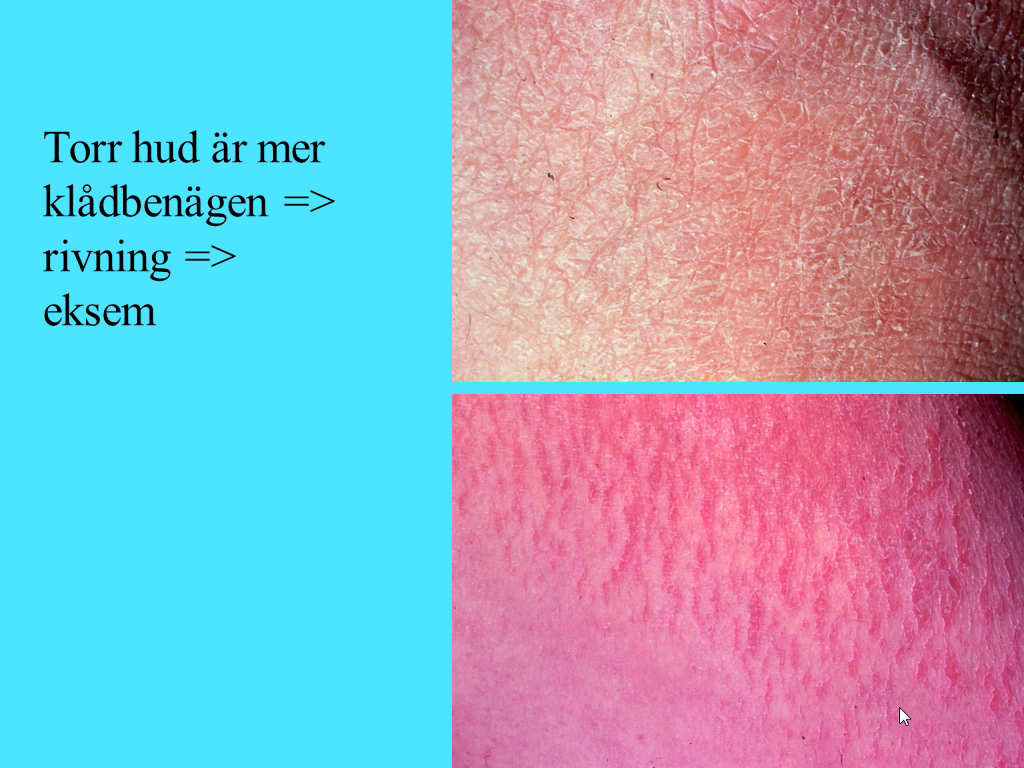 Hudsjukdomar del 2 av 4 - Medfarm Play - Uppsala universitet