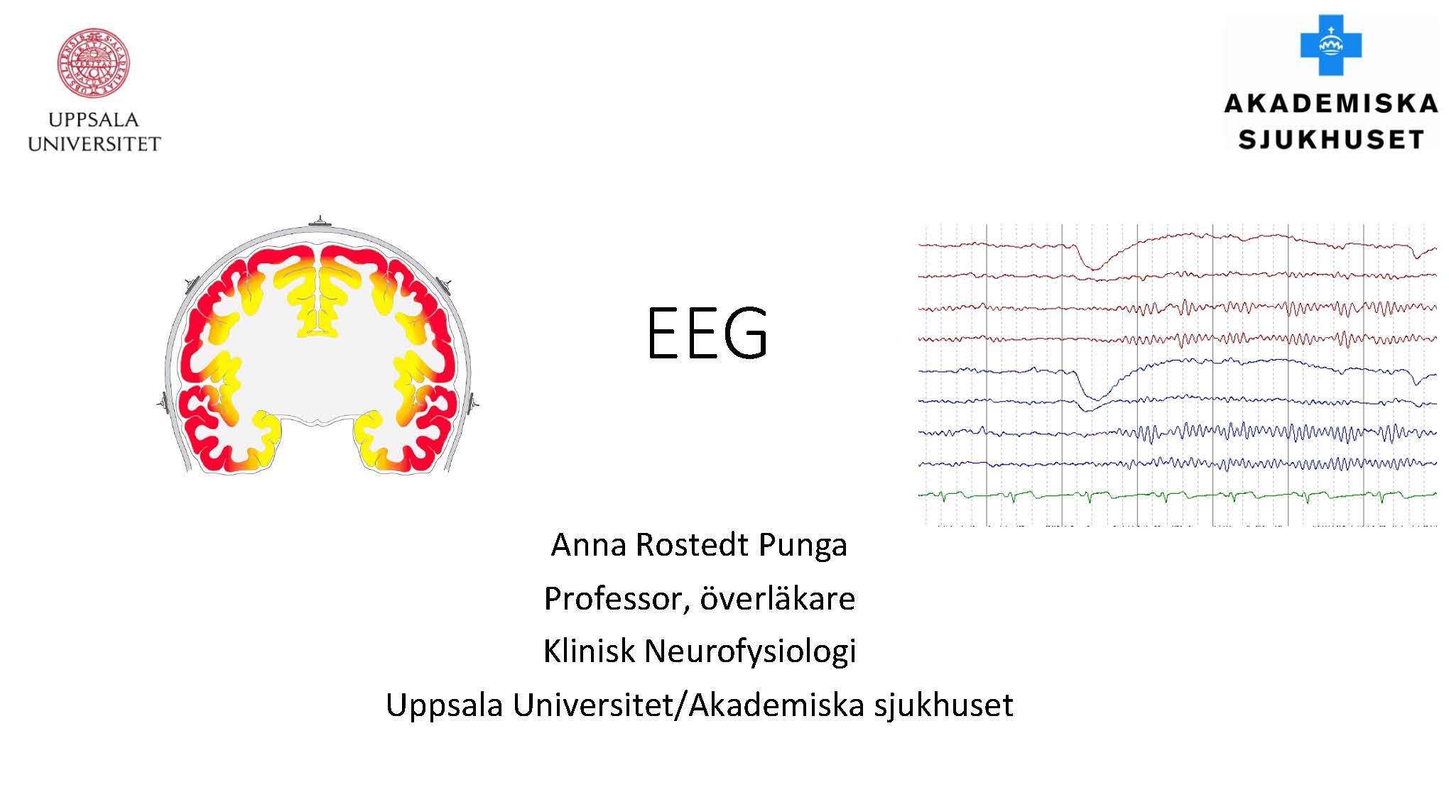 EEG - Medfarm Play - Uppsala universitet