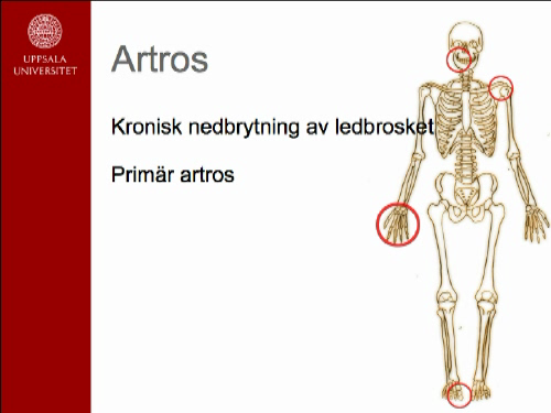 Ortopedisk omvårdnad Artros... - Medfarm Play - Uppsala universitet